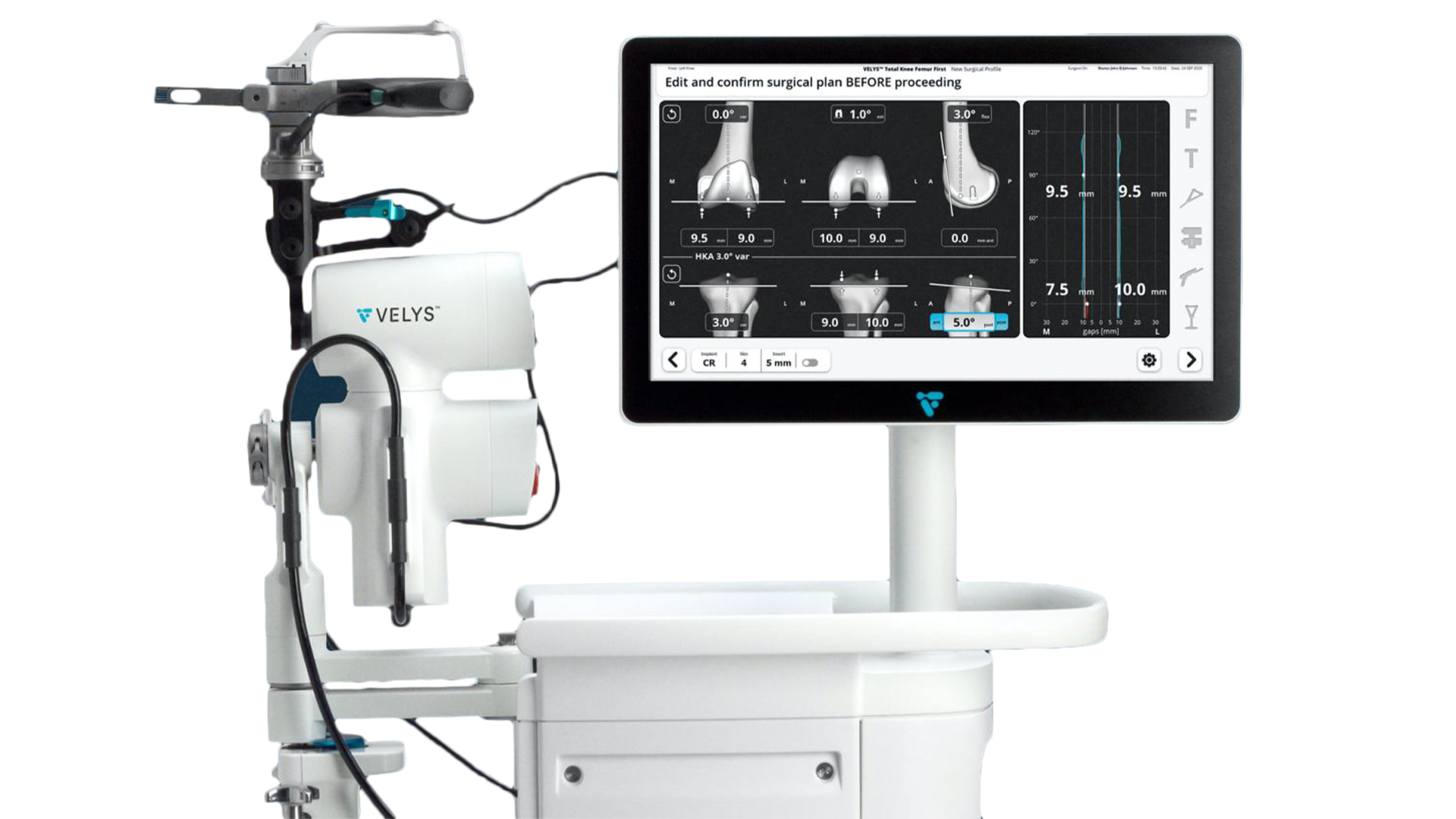 Knee replacement surgical robot – Fondation Hôpital Charles-LeMoyne